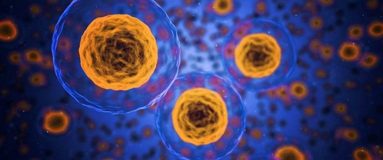 Sarcom - Tot ce trebuie să ştii despre acest tip de cancer - Cancer360