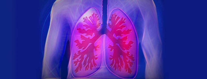 Metastaza - Ce sunt metastazele canceroase | Cancer360