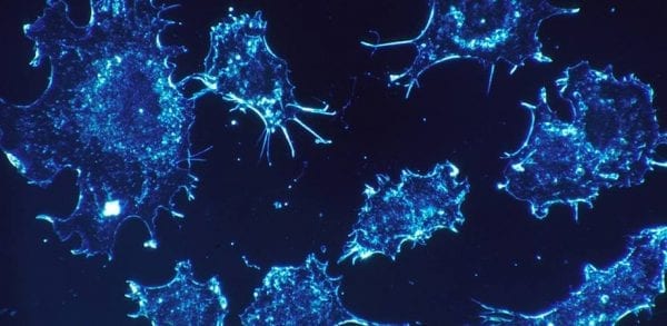 Antigenul carcinoembrionar (CEA) - Cancer360