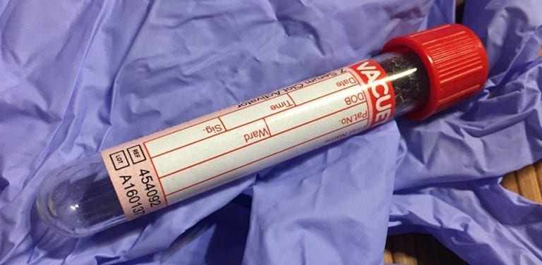 Electroforeza proteinelor serice – recomandare, boli - Cancer360