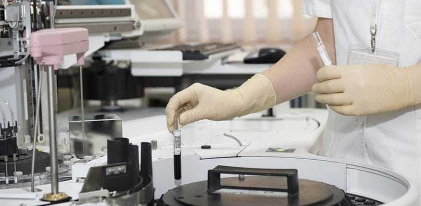 Totul despre viteza de sedimentare a hematiilor (VSH) - Cancer360