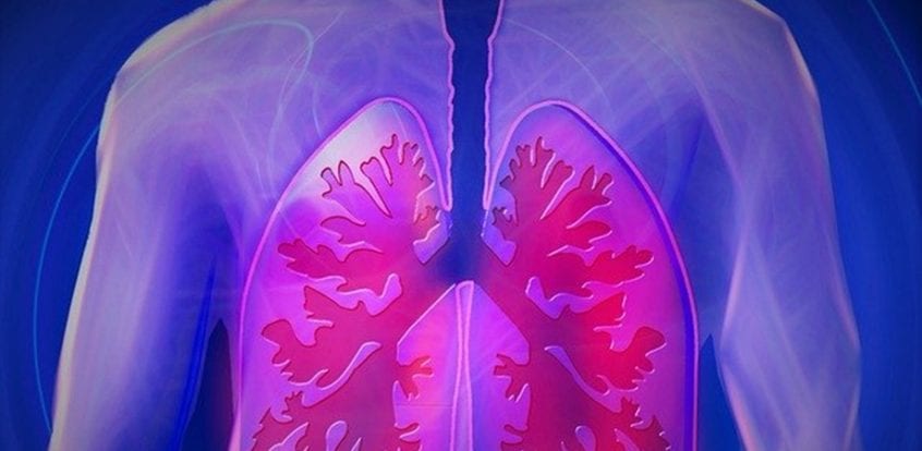 Bronhoscopia – cand este necesara aceasta analiza? - Cancer360