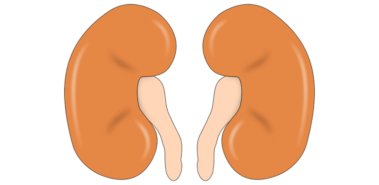 Chisturi la rinichi: simptome, cauze, tratament - Cancer360