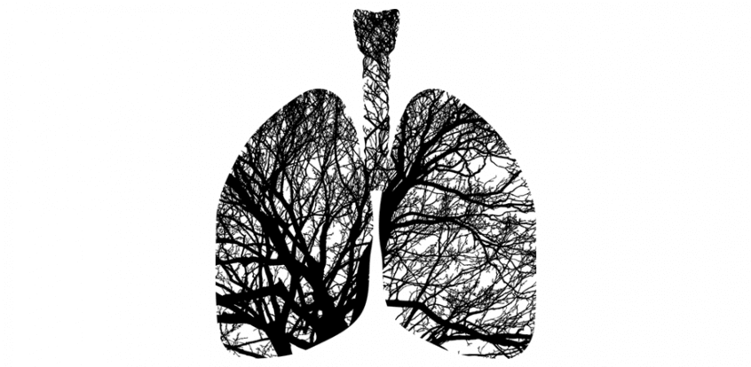 Apa la plamani (pleurezia) – ce boli poate ascunde - Cancer360