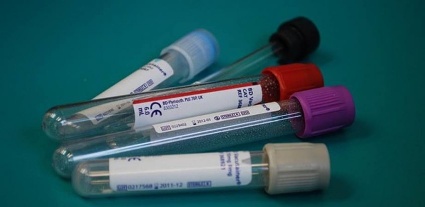 Leucocite scazute - ce inseamna si care sunt cauzele - Cancer360