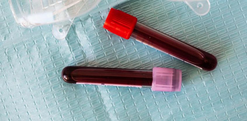 Leucocite crescute - ce inseamna si care sunt cauzele - Cancer360