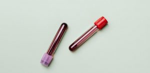 Eritrocite crescute - ce inseamna si care sunt cauzele - Cancer360